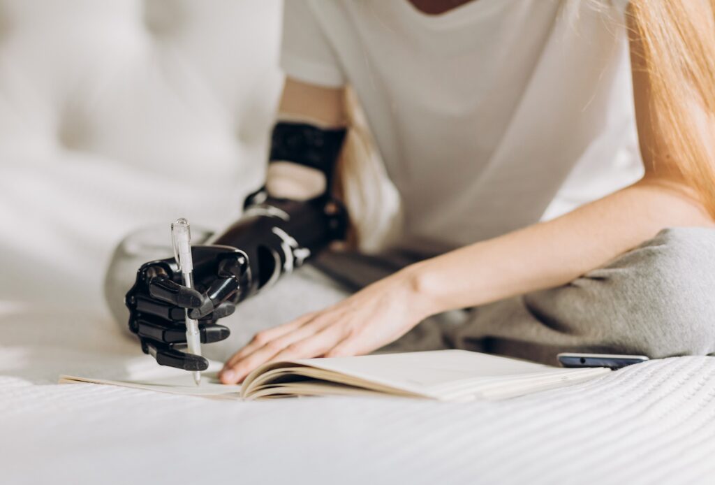 Artificial Intelligence in Prosthetics - Motion Orthopedic