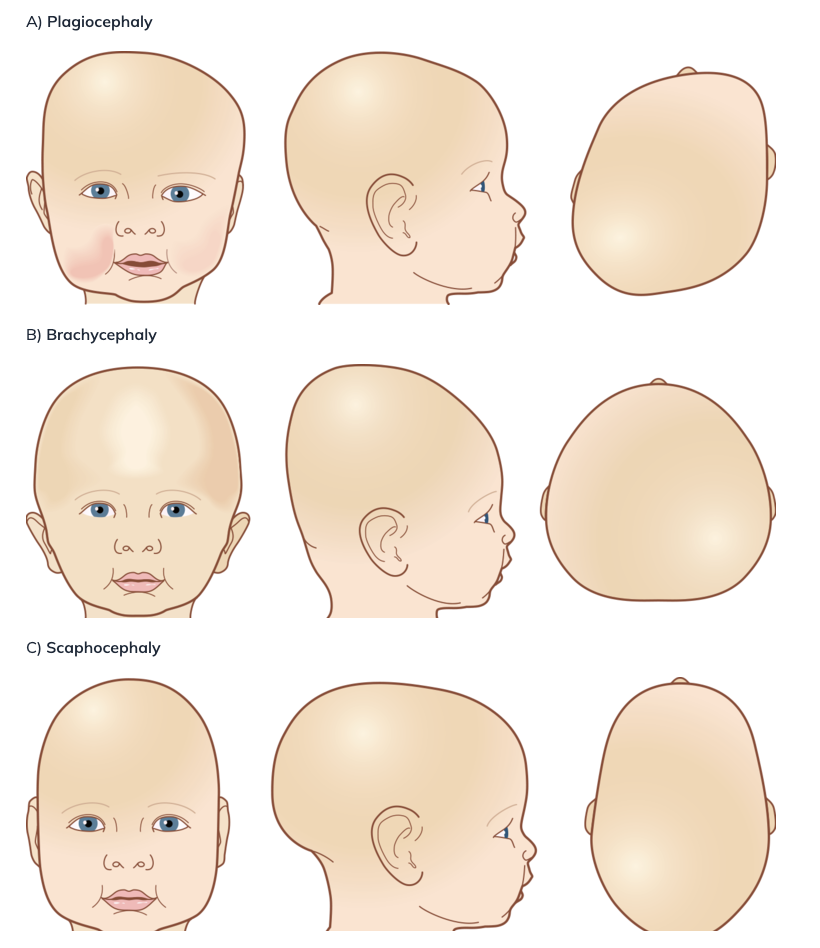 Orthotics - Motion Orthopedic